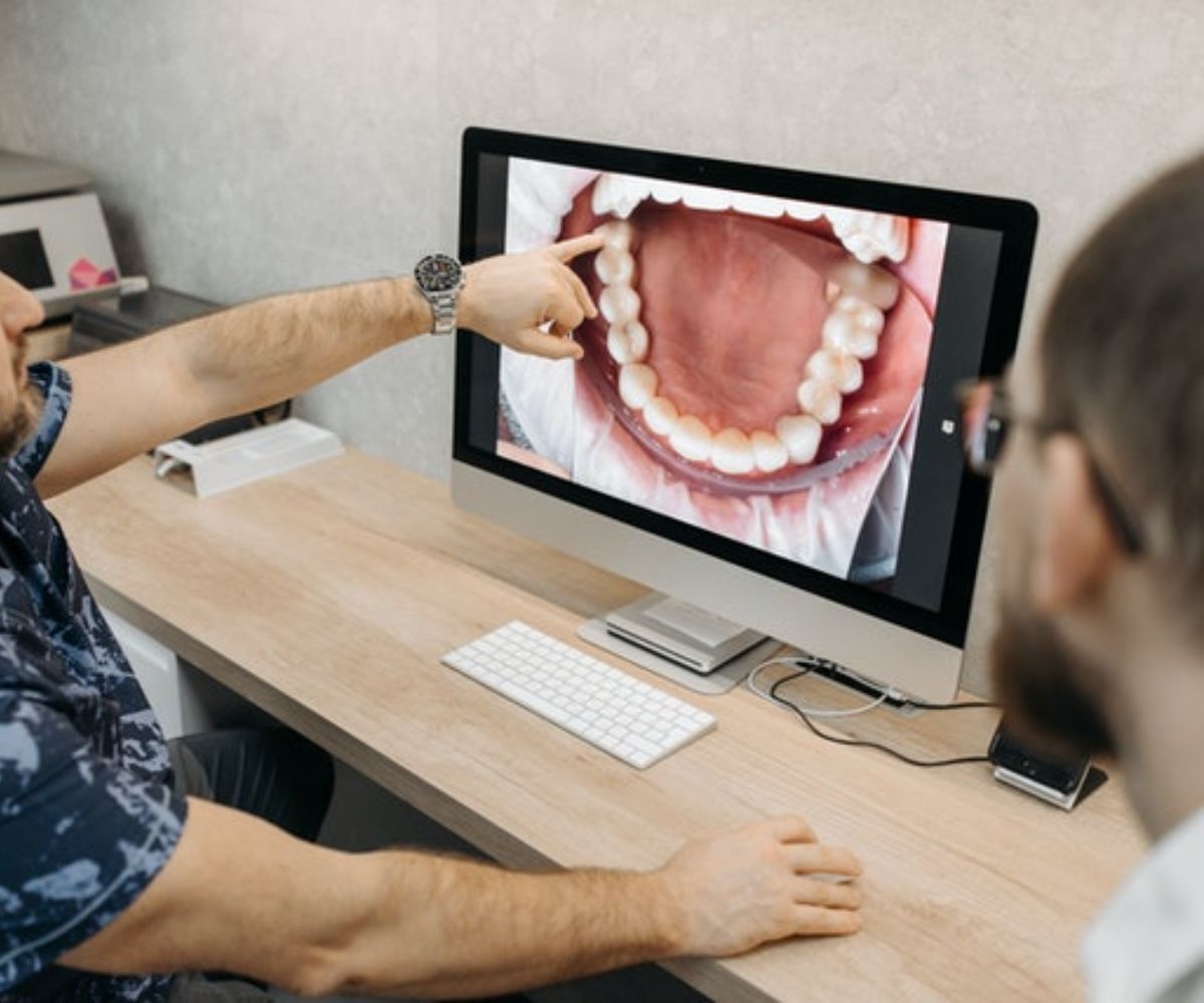 Todo acerca de la Mordida Torcida | Quatre Dental